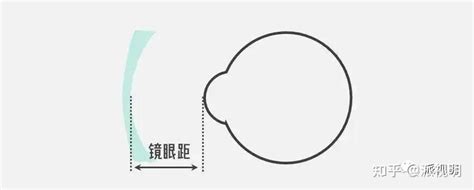镜架没选对，防控全白费 配离焦镜片选择镜架很重要，这几个方面你需要关注 知乎