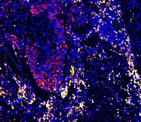 Spatial Biology Enzo