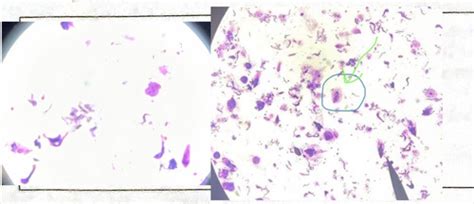 Lab Assignment 3 Ppt Protist Ii Flashcards Quizlet