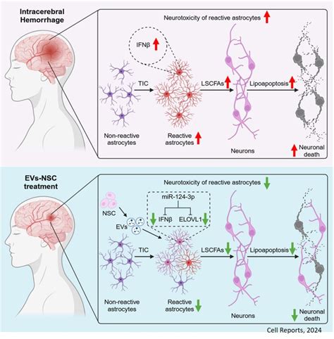 How Extracellular Vesicles From Neural Stem Cells Protect Against Intracerebral Hemorrhage