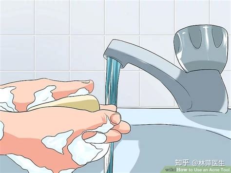 针清的详细说明 知乎