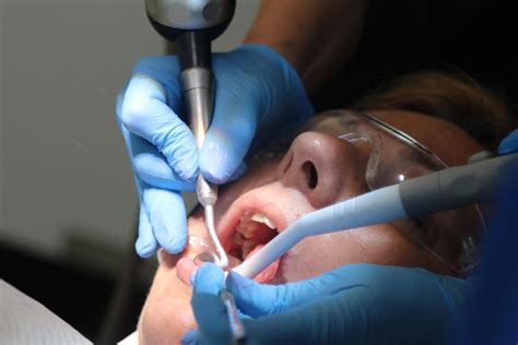 Toothache Causes Treatments And Prevention Forestside
