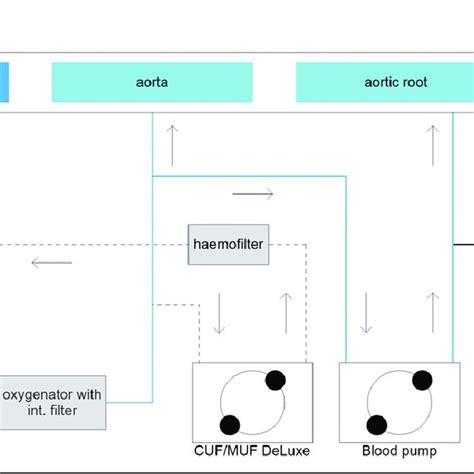 Charting Of A Complete Cpb Setup In The Application Of Paediatric