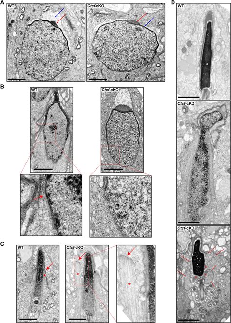 elongated spermatids show chromatin compaction and sperm head defects download scientific