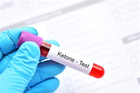 ¿cómo Entrar En Cetosis En 5 Pasos Guía Para Keto Principiantes
