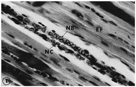 Figure 1 From Fine Structure Of Rat Intrafusal Muscle Fibers Semantic Scholar