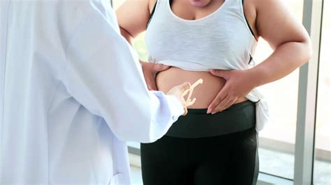 Who Is Eligible For Gastric Bypass Surgery