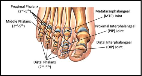 Stubbing Your Toe The Manageable The Bad And The Ugly Footeducation