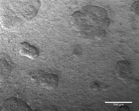 34 Lung Progenitor Cells Day 15 Of Differentiation Scale Bar 500