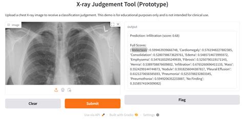 How To Build A Prototype X Ray Judgment Tool Open Source Medical Inference System Using