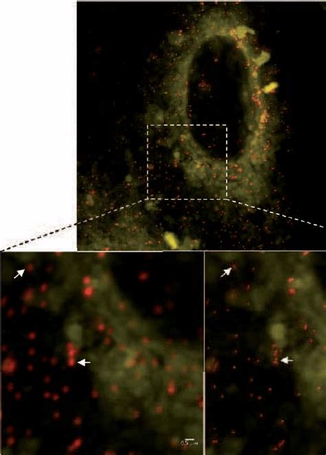 Top A549 Human Lung Epithelial Cell Yellow Dii Membrane Stain After