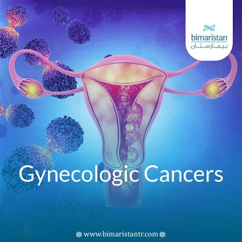 Gynecologic Cancers Types Causes And Treatment Options