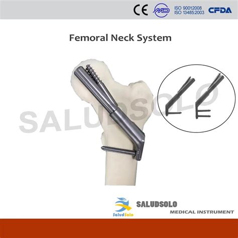 Système De Col Fémoral Système Fns Dedicated Fixation For Femmoral Neck Fractures Isoandce