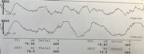 CSA Examples Paediatric Emergencies