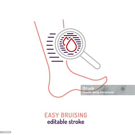Easy Bruising Outline Icon Bleeding Disorder Linear Sign Stock