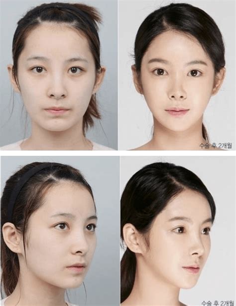 성형전이 훨씬 이쁜 일반인 레전드 에누리 쇼핑지식 자유게시판