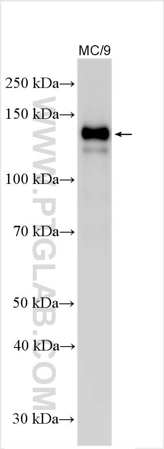 Cd117 C Kit Antibody 31337 1 Ap Proteintech