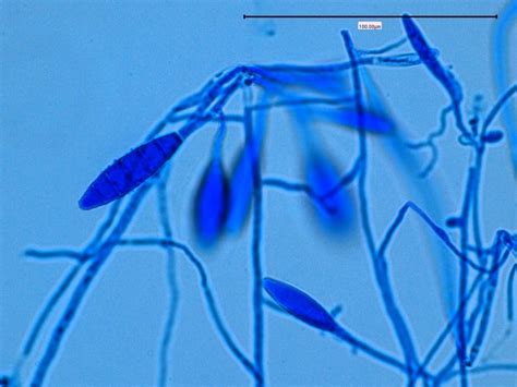 Fun With Microbiology What S Buggin You Microsporum Gypseum