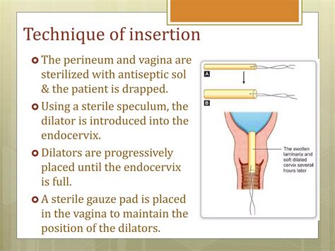 Induction Of Labour PPTX