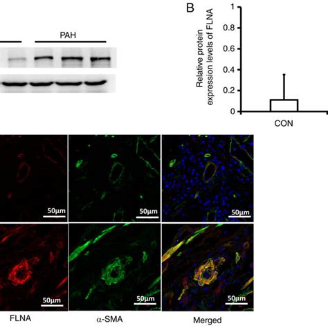 Flna Deficiency In Smooth Muscle Cells Alleviates Pulmonary Arterial Download Scientific