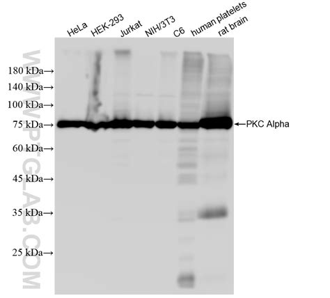 Pkc Alpha Antibody 83840 6 Pbs Proteintech