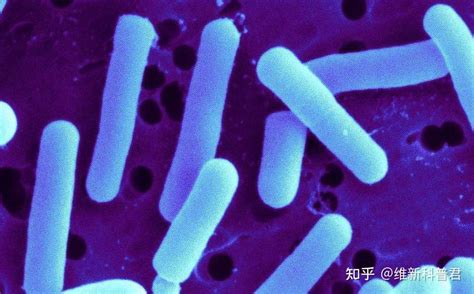 揭秘幽门螺杆菌的克星让你抗菌不走弯路 知乎