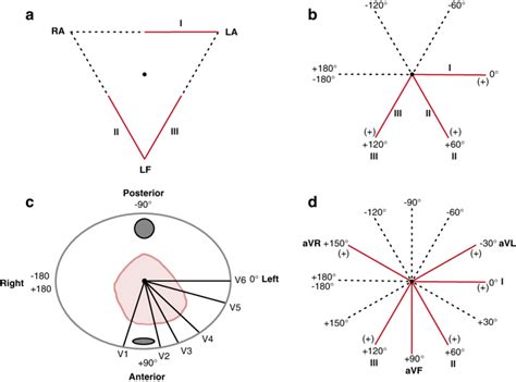 1 Lead Axes Of The Standard 12 Lead Ecg Bipolar Limb Leads I Ii And Download Scientific