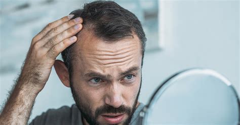 Prednisone And Hair Loss What You Need To Know Justinboey