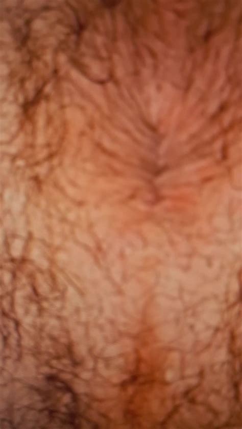 Hairy Hole Winking Hairy Hole Winking