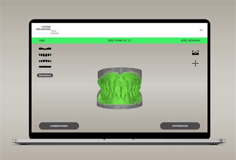 Prothèse Dentaire Numérique Lafond Desjardins