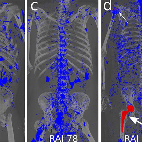 Visualizations At Various Stages Of Decomposition A Minimal
