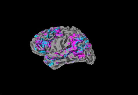 Scientists Have Developed An AI Decoder That Can Translate Brain Activity Into Words