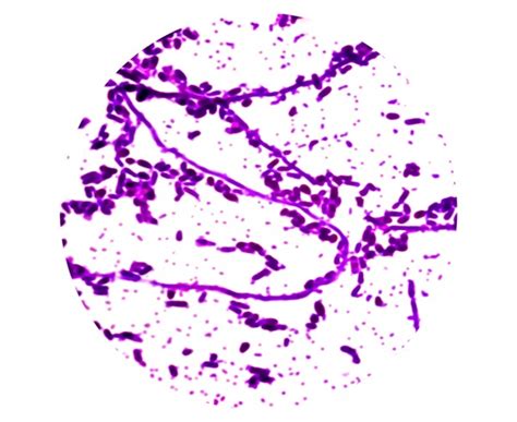 Candidiasis Microscopy