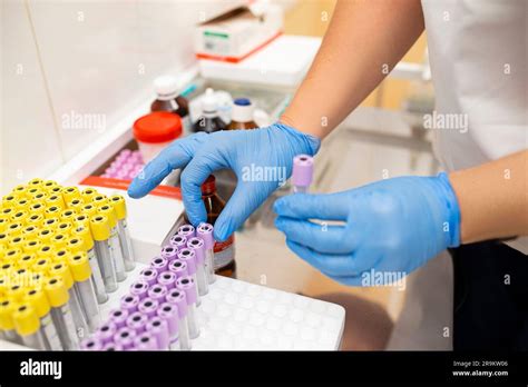 Many Boxes With Laboratory Test Tubes In The Clinic A Laboratory Assistant Works With Test