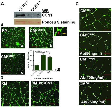 Pancreatic Cancer Cell Secreted Ccn1 Pccs Ccn1 Promotes Tumor