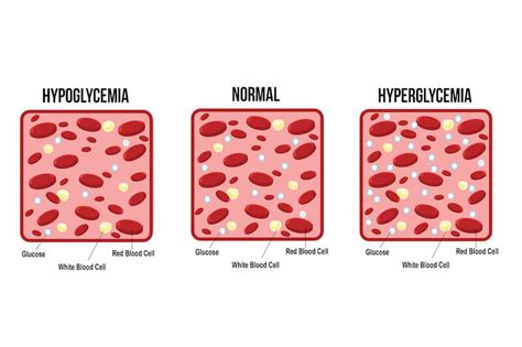 Hyperglycemia Vs Hypoglycemia What S The Difference