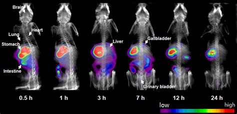 Representative Whole‐body Positron Emission Tomographycomputed Download Scientific Diagram