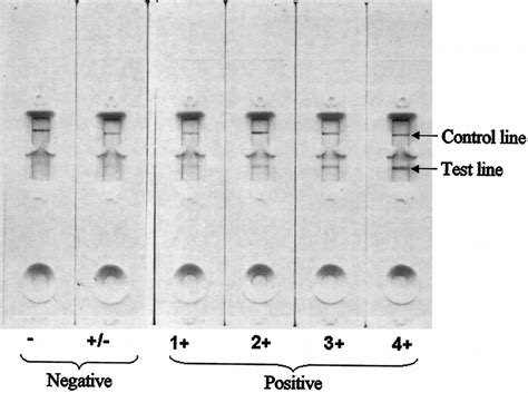 ML Flow Test Results The Test Is Scored Positive When A Distinct Download Scientific Diagram