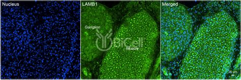 Laminin Beta 1 Lamb1 Hire Antibody Bicell Scientific®