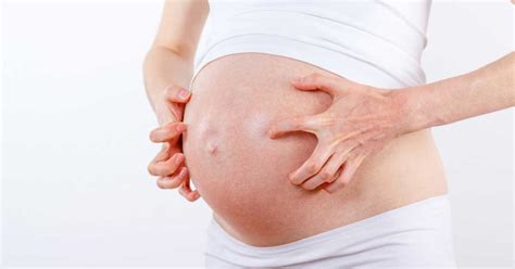 Kako da pojačan svrab u trudnoći prestane Rastimo zdravo