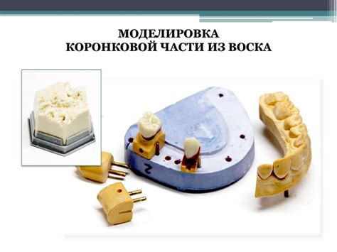 Изготовление цельнолитого комбинированного мостовидного протеза