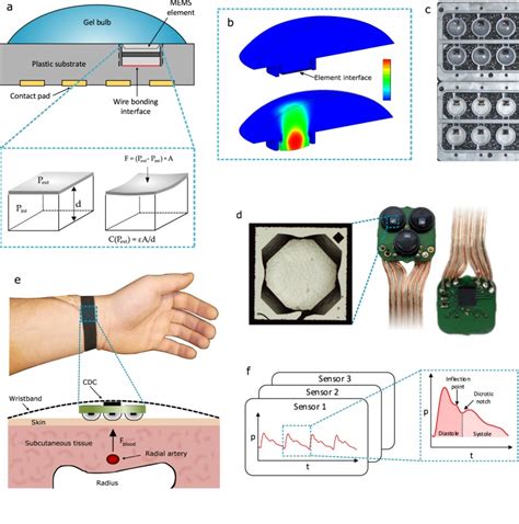 Clinical Assessment Of A Non Invasive Wearable Mems Pressure Sensor