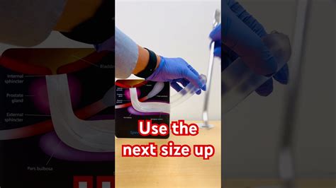 Urethral Dilation Cpt Codes Your Ultimate Billing Guide 2024 Sciencestream Blog