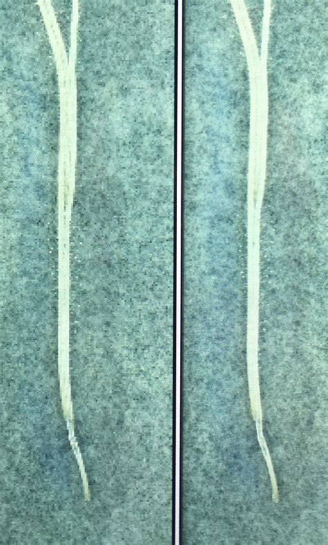 problem with picture quality in imagej pictures are pixelated usage