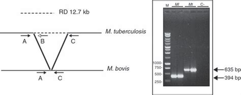 Scheme Of The Multiplex Pcr For Differentiation Between Mycobacterium Download Scientific