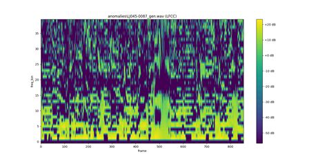 AudioDeepFakeDetection