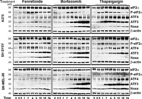 Fenretinide And Bortezomib Regulate Eif2 ␣ Signaling In Neuroectodermal