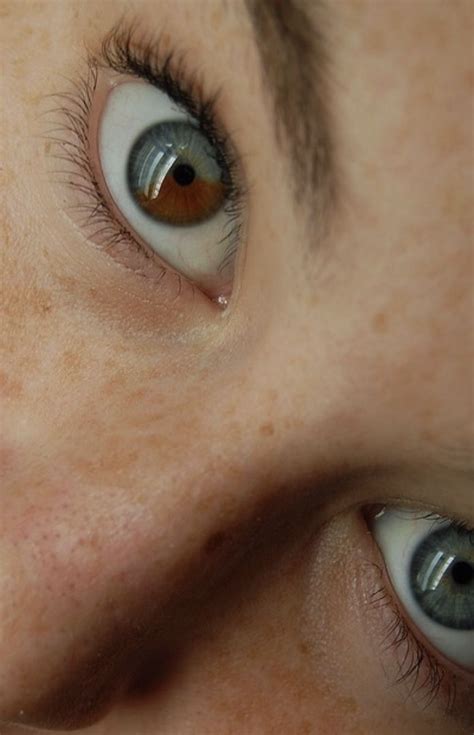 Beautiful Eyes Color Pretty Eyes Cool Eyes Heterochromia Eyes Rare