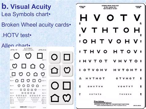 Pediatric Eye And Vision Ppt