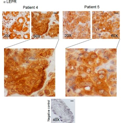 Representative Ihc Staining Images Two Patients Of Human Bone